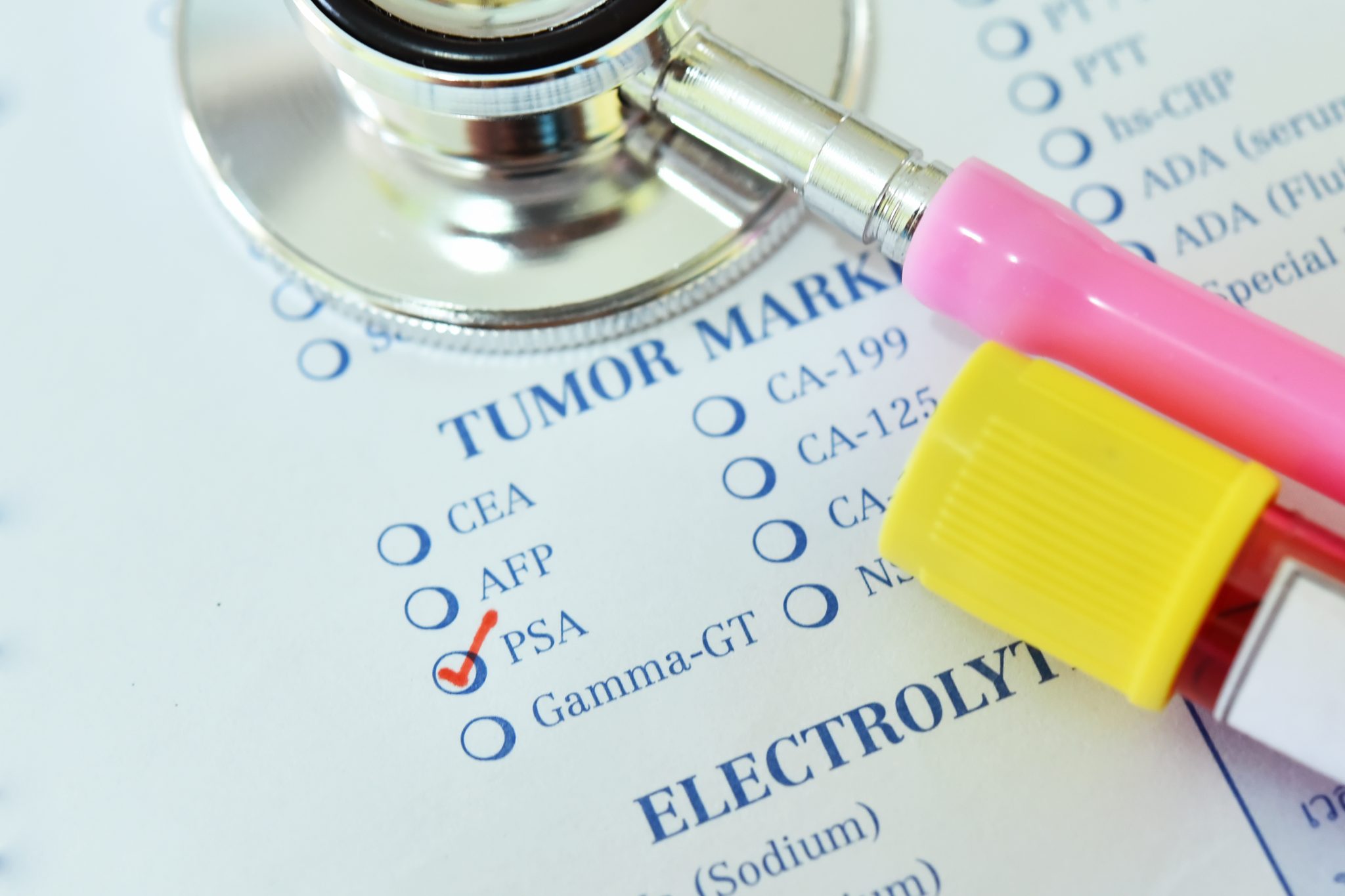 PSA and PSMA: improving prostate cancer treatment